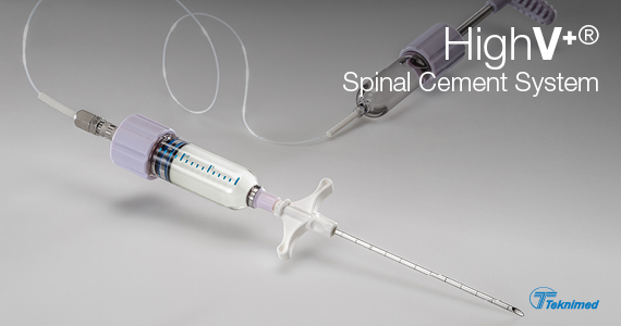 HighV+® Spinal Cement System - Teknimed